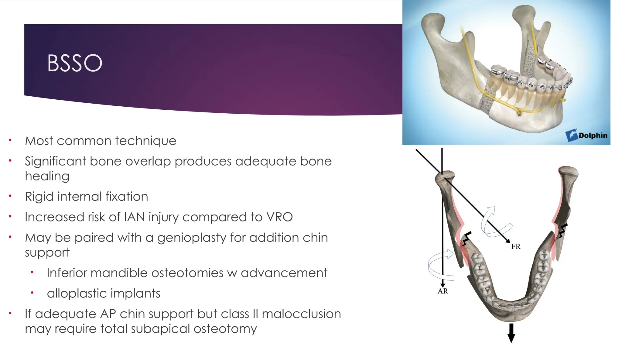 Correction of Dentofacial Deformities by Mari-Alina Timoshchuk.pptx