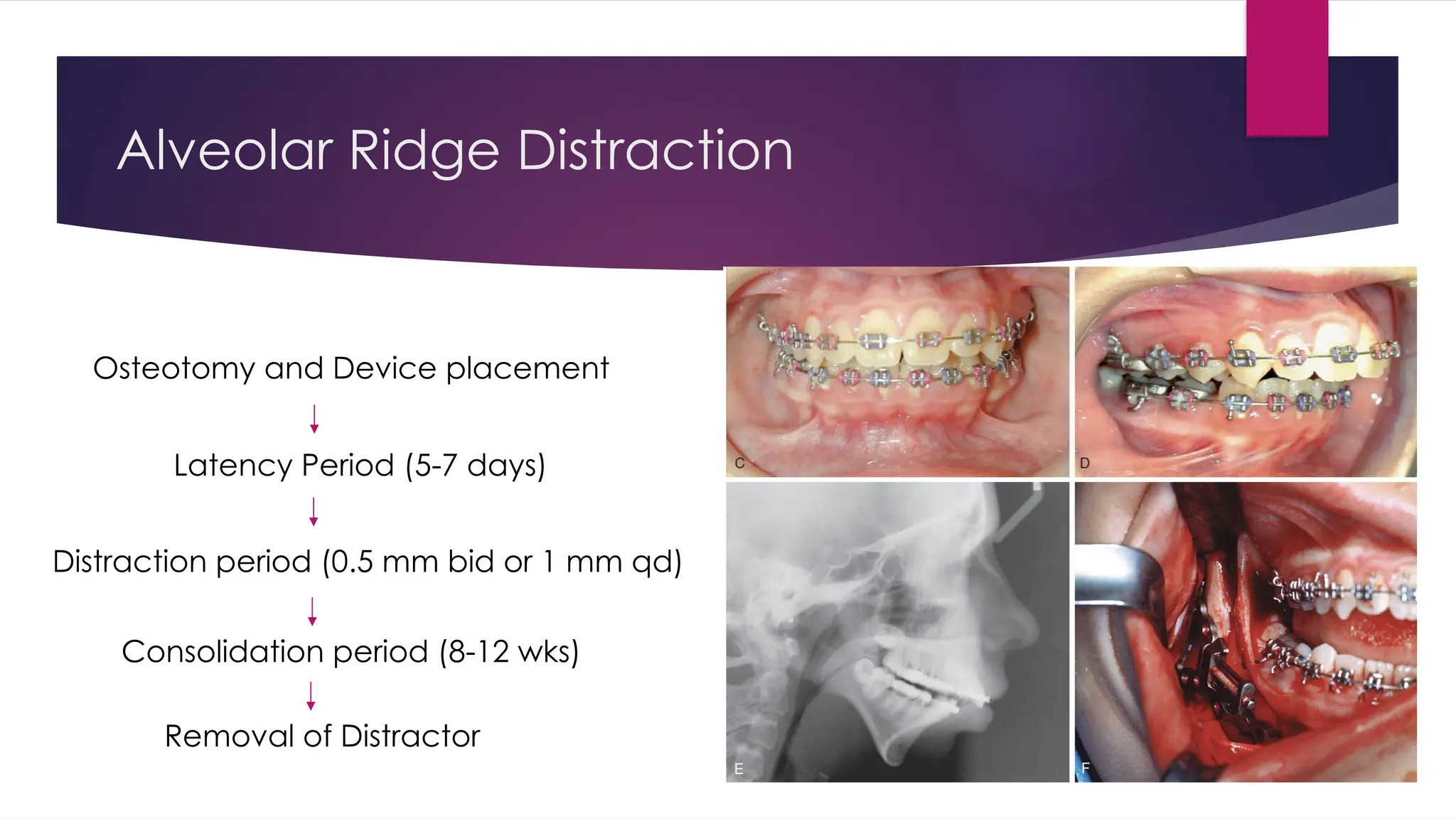 Correction of Dentofacial Deformities by Mari-Alina Timoshchuk.pptx