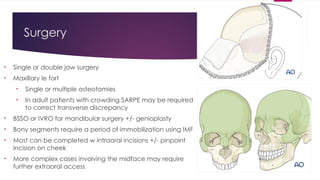 Correction of Dentofacial Deformities by Mari-Alina Timoshchuk.pptx