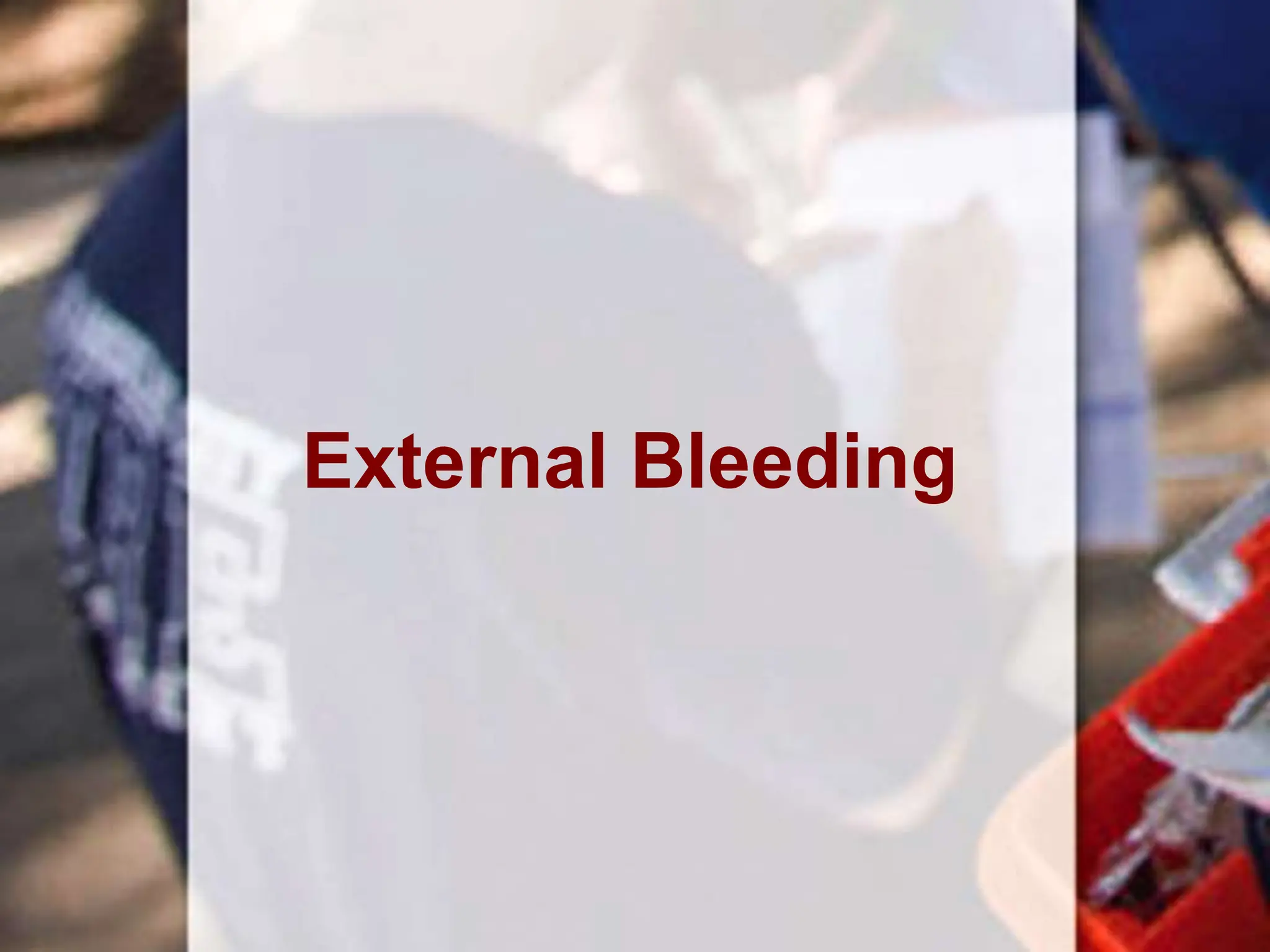 Ch 28 Bleeding and Soft Tissue Injuries.ppt