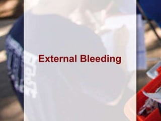 Ch 28 Bleeding and Soft Tissue Injuries.ppt