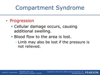 Ch28 muscleskel | PPT | Death, Injury, or Military Conflict | Sensitive Topics