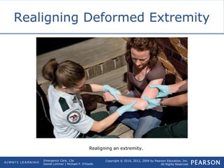 Ch28 muscleskel | PPT | Death, Injury, or Military Conflict | Sensitive Topics