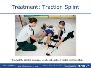 Ch28 muscleskel | PPT | Death, Injury, or Military Conflict | Sensitive Topics