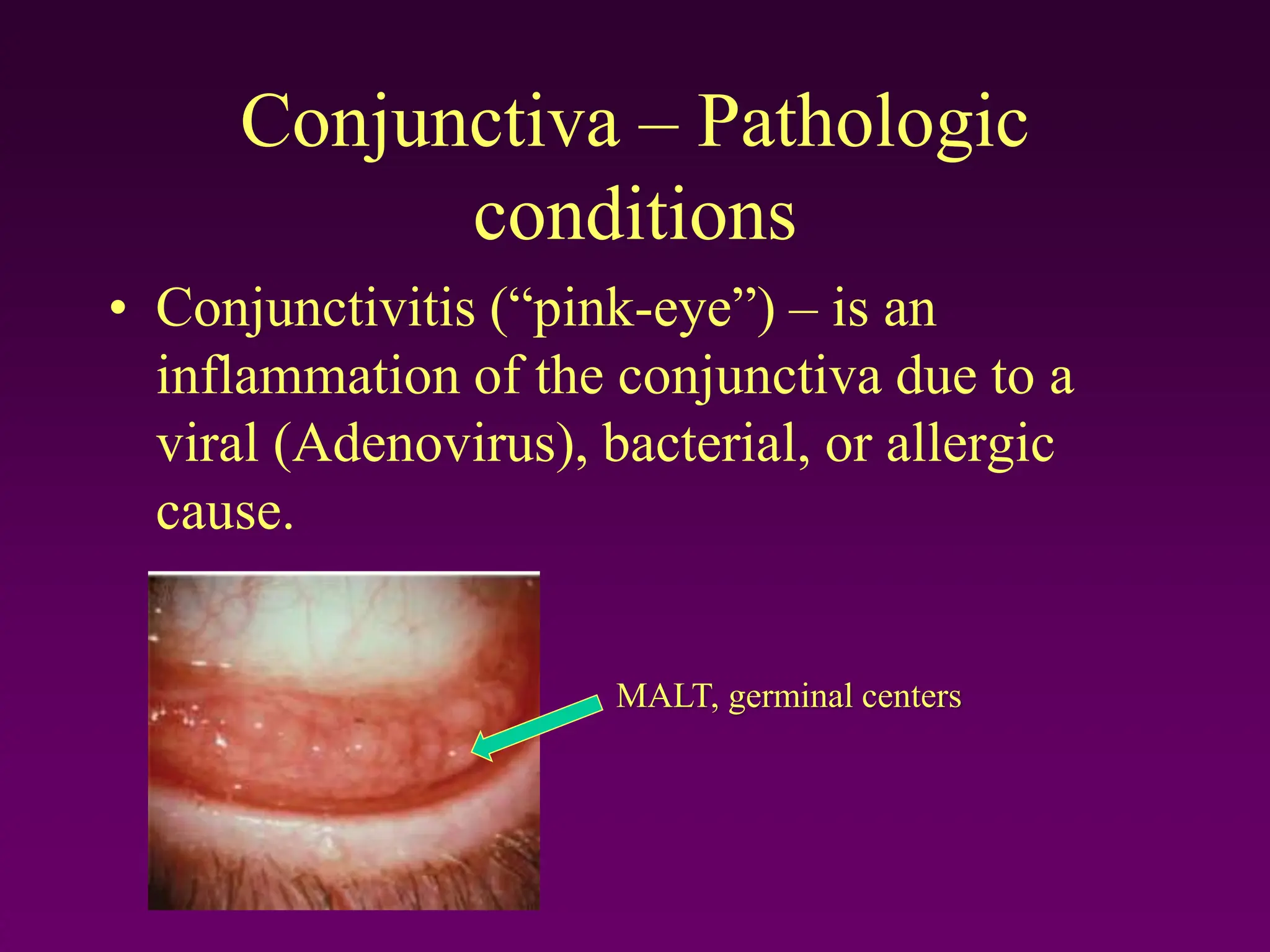 Ch29-Eye pathology of eye..Chapter 19 .ppt