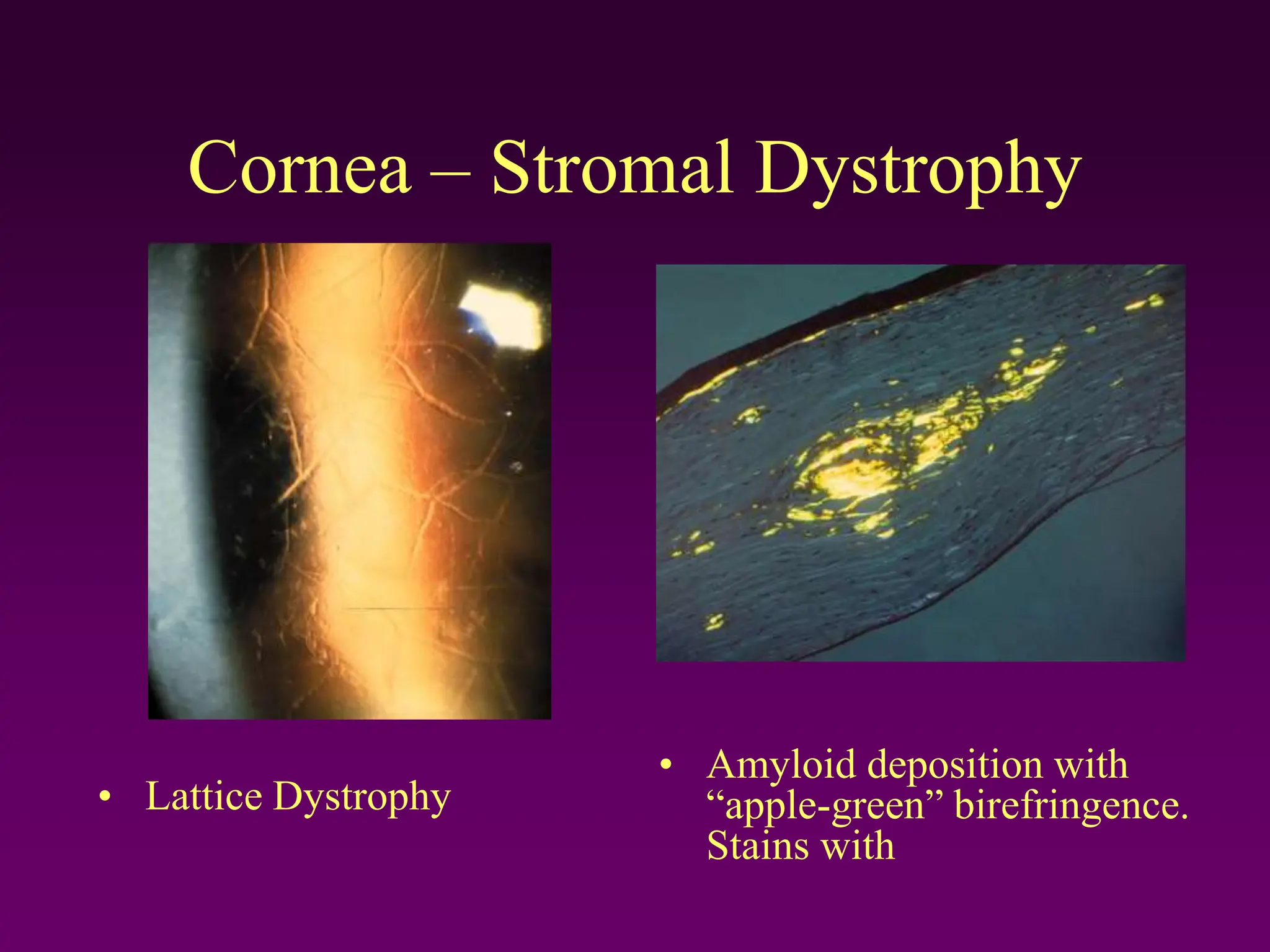 Ch29-Eye pathology of eye..Chapter 19 .ppt
