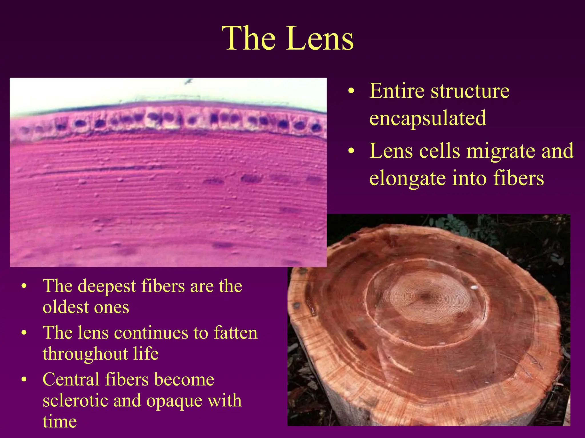 Ch29-Eye pathology of eye..Chapter 19 .ppt