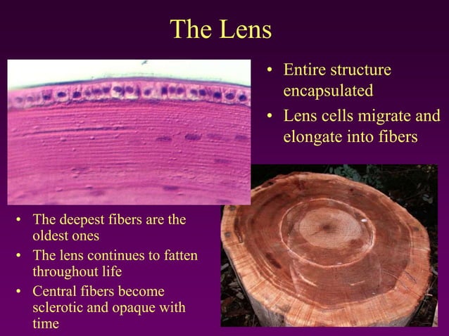 Ch29-Eye pathology of eye..Chapter 19 .ppt