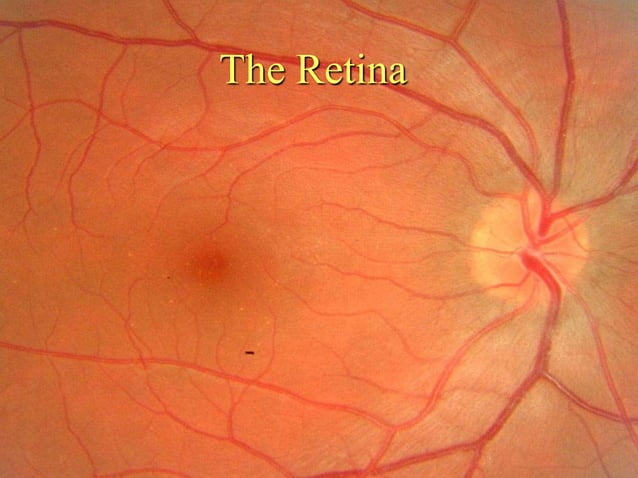 Ch29-Eye pathology of eye..Chapter 19 .ppt