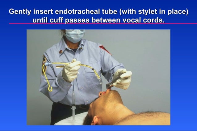 Advanced Airway Management | PPT | First Aid | Injuries