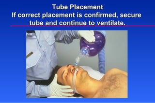 Advanced Airway Management | PPT