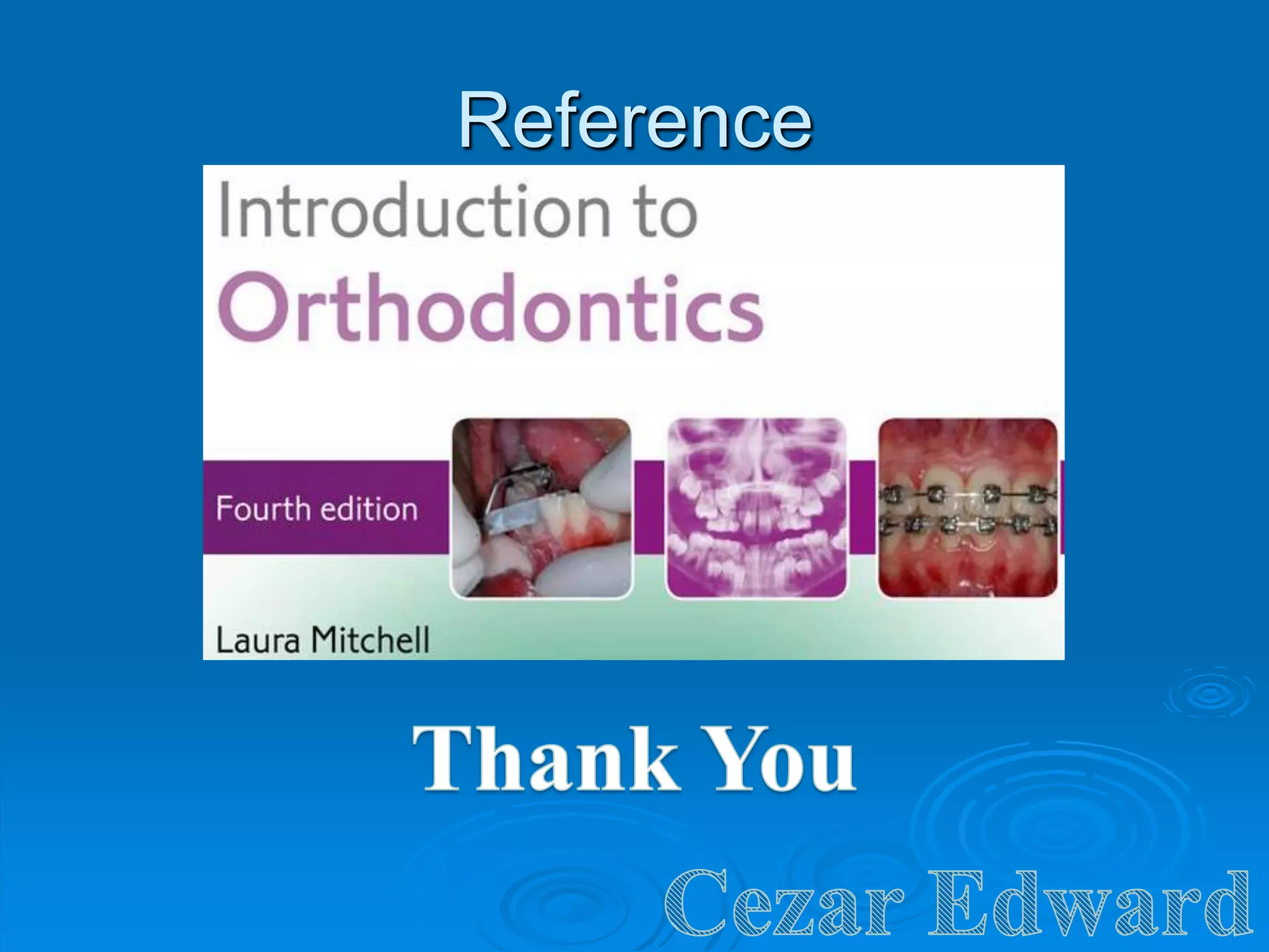 Ch2 lec2 orthodontics "Classifications " | PDF
