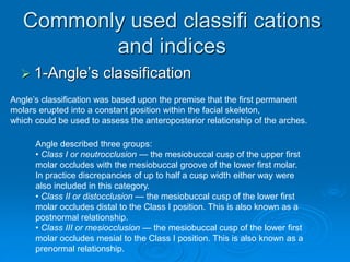 Ch2 lec2 orthodontics "Classifications " | PDF