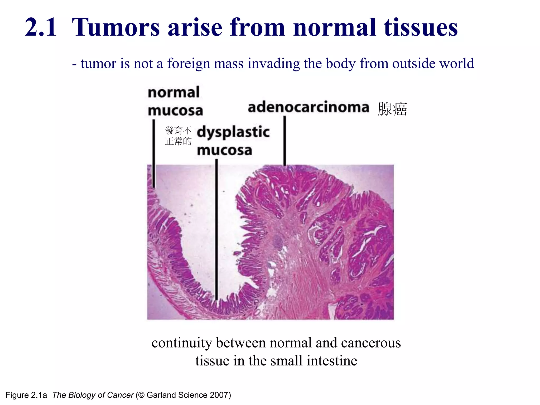 Ch_2_The_Nature_of_Cancer.ppt