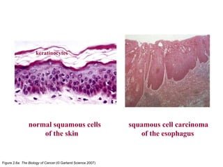 Ch_2_The_Nature_of_Cancer.ppt