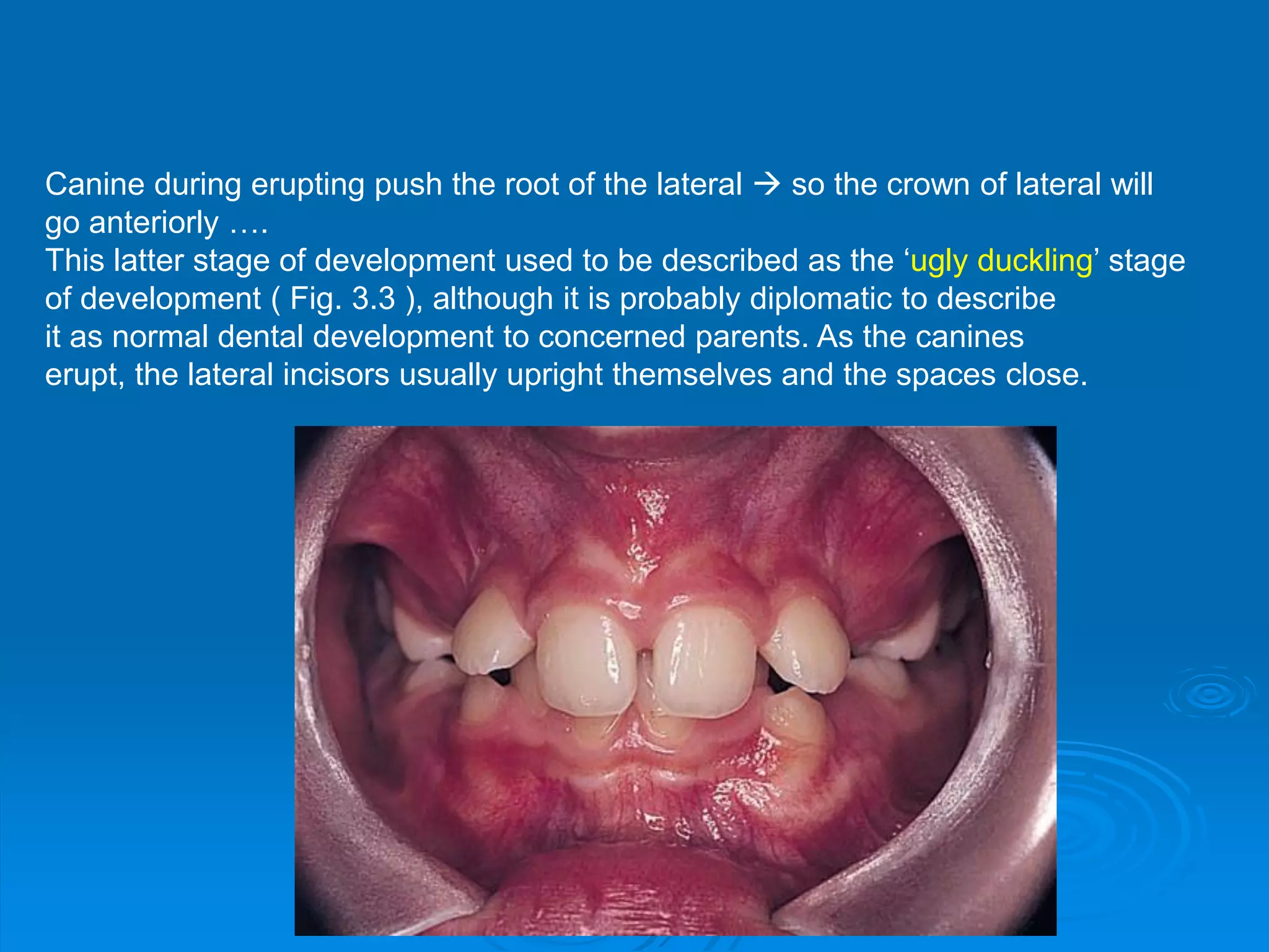 Ch3 Orthodontics "management of developing dentition | PDF