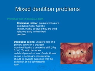 Ch3 Orthodontics "management of developing dentition | PPT | Free Download