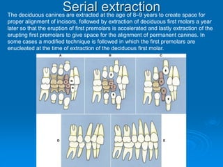Ch3 Orthodontics "management of developing dentition | PDF