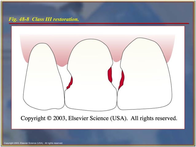 Restorative and Esthetic Dentistry | PPT