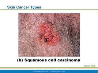 Ch4ppt integument | PPT