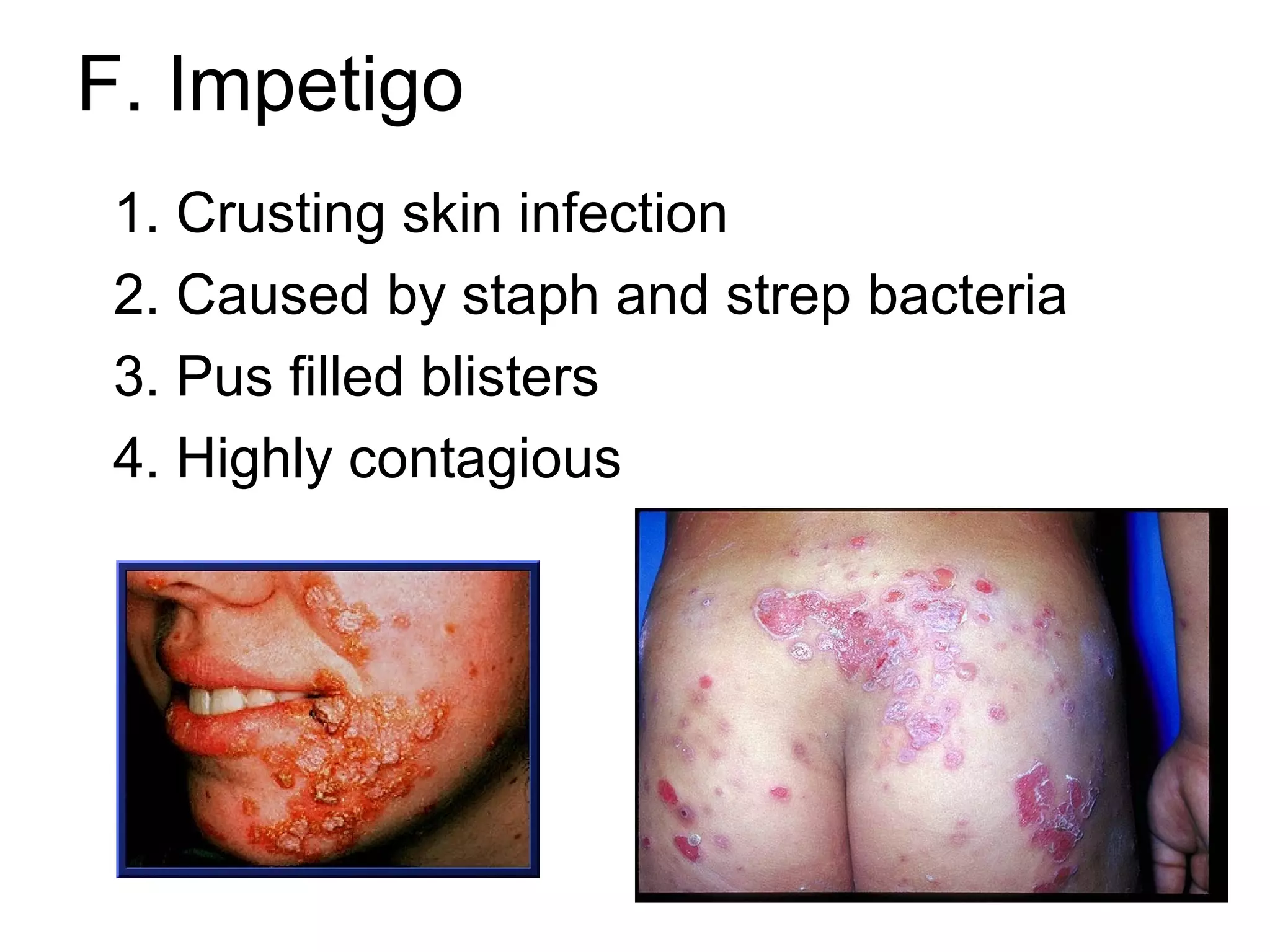 Ch 4 skin problems | PPT