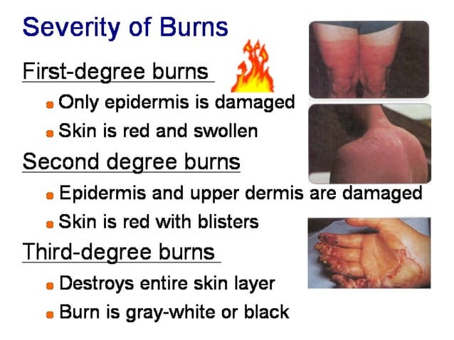 Ch 4 skin problems | PPT
