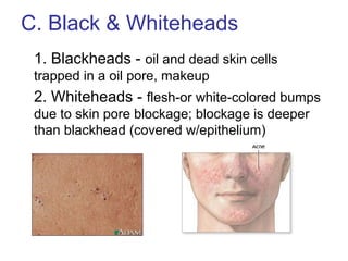 Ch 4 skin problems | PPT