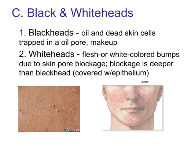 Ch 4 skin problems | PPT