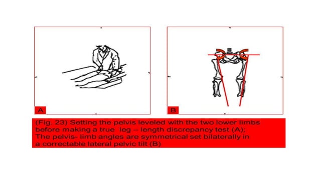 ch 4 t m hip joint part 3.pptx