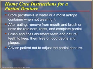 Ch52 removable prosthodontics | PPT