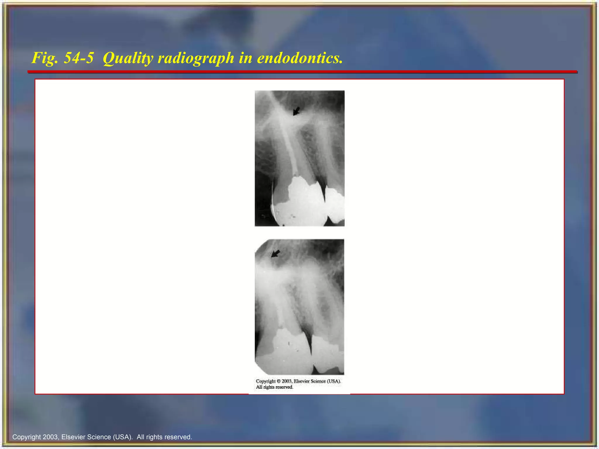 endodontics | PPT
