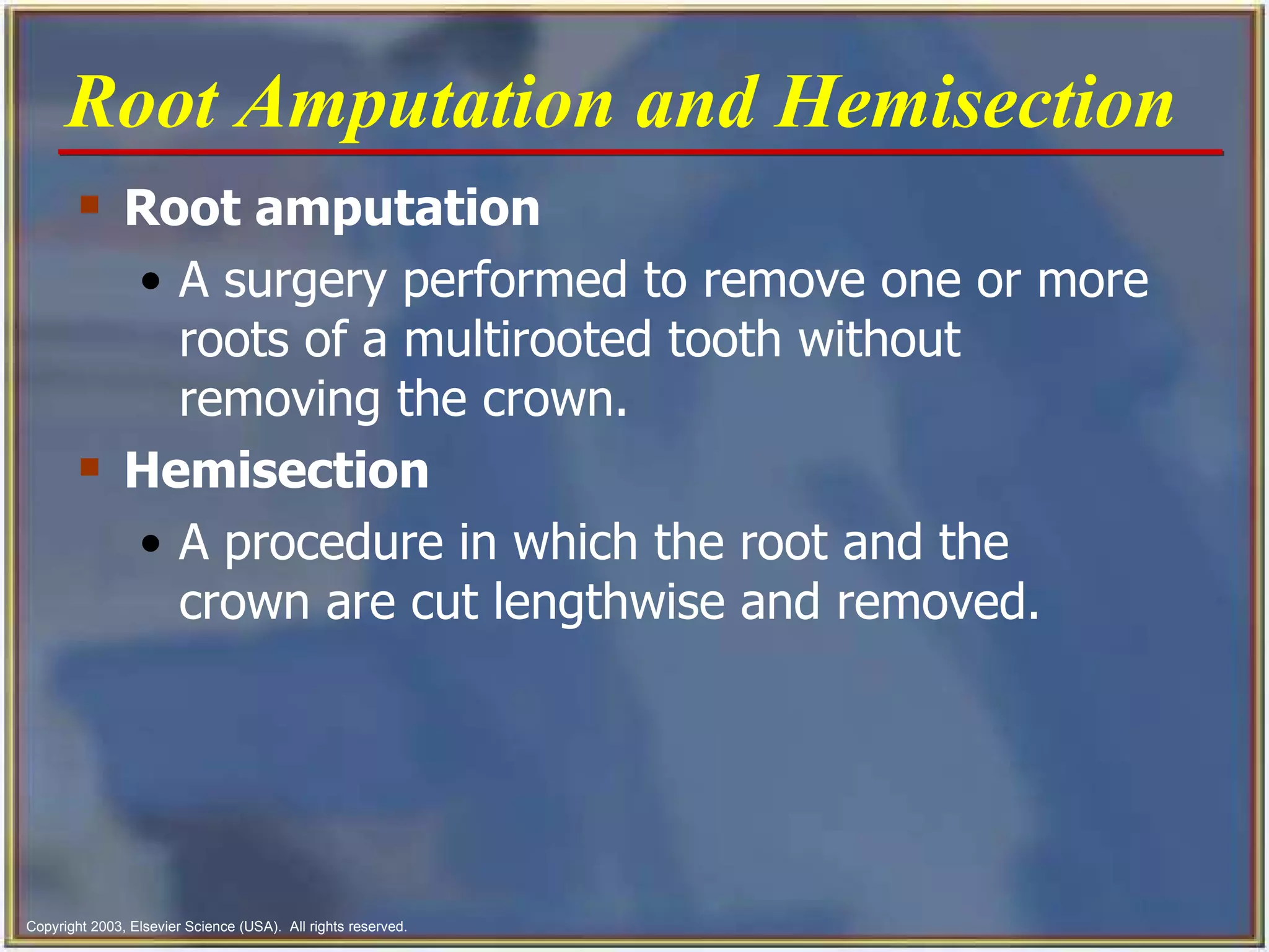 endodontics | PPT
