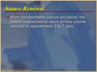 ch56 (1).ppt