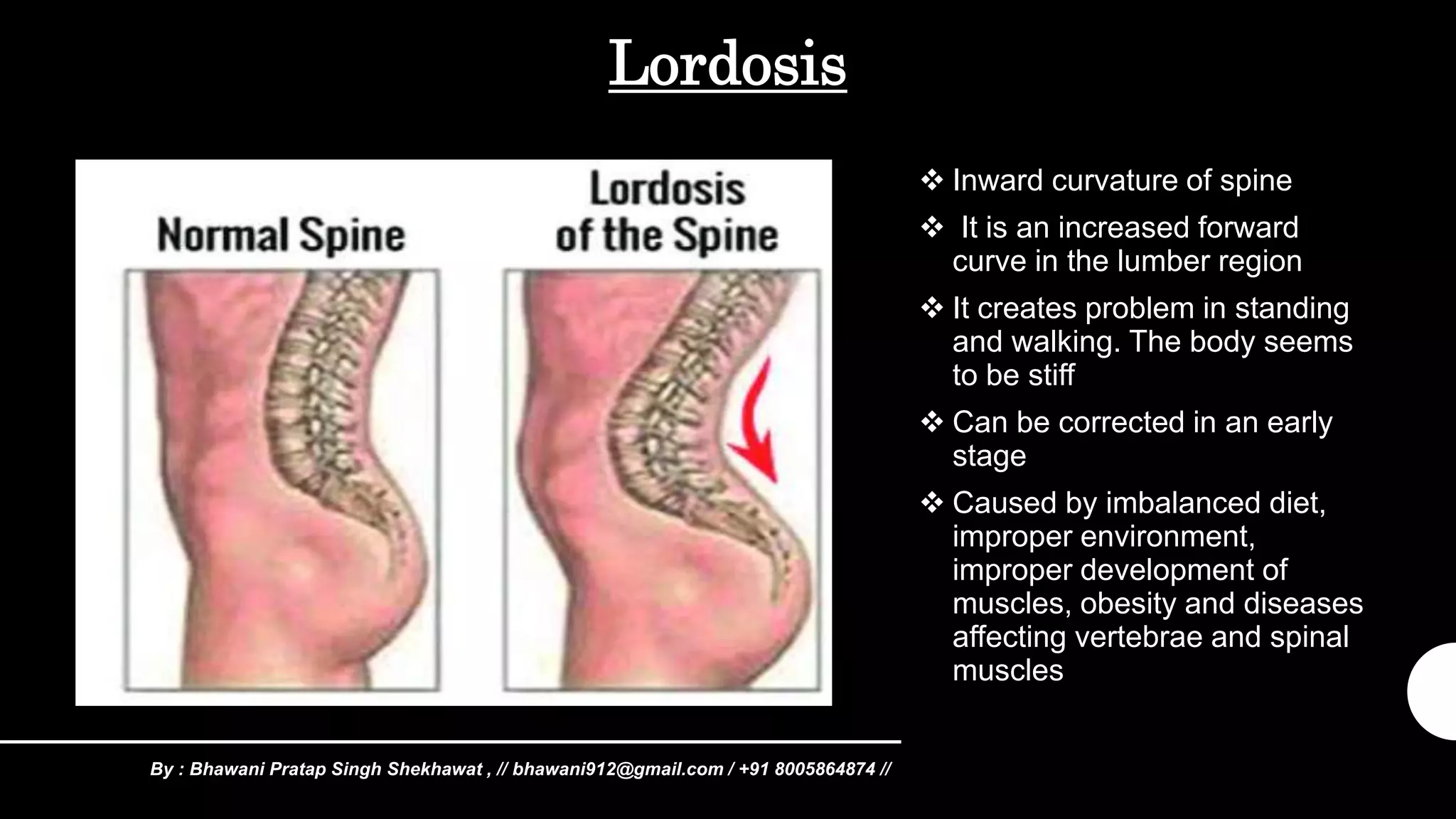 class 12th Ch 5 children and women in sports cbse by bhawani pratap ...