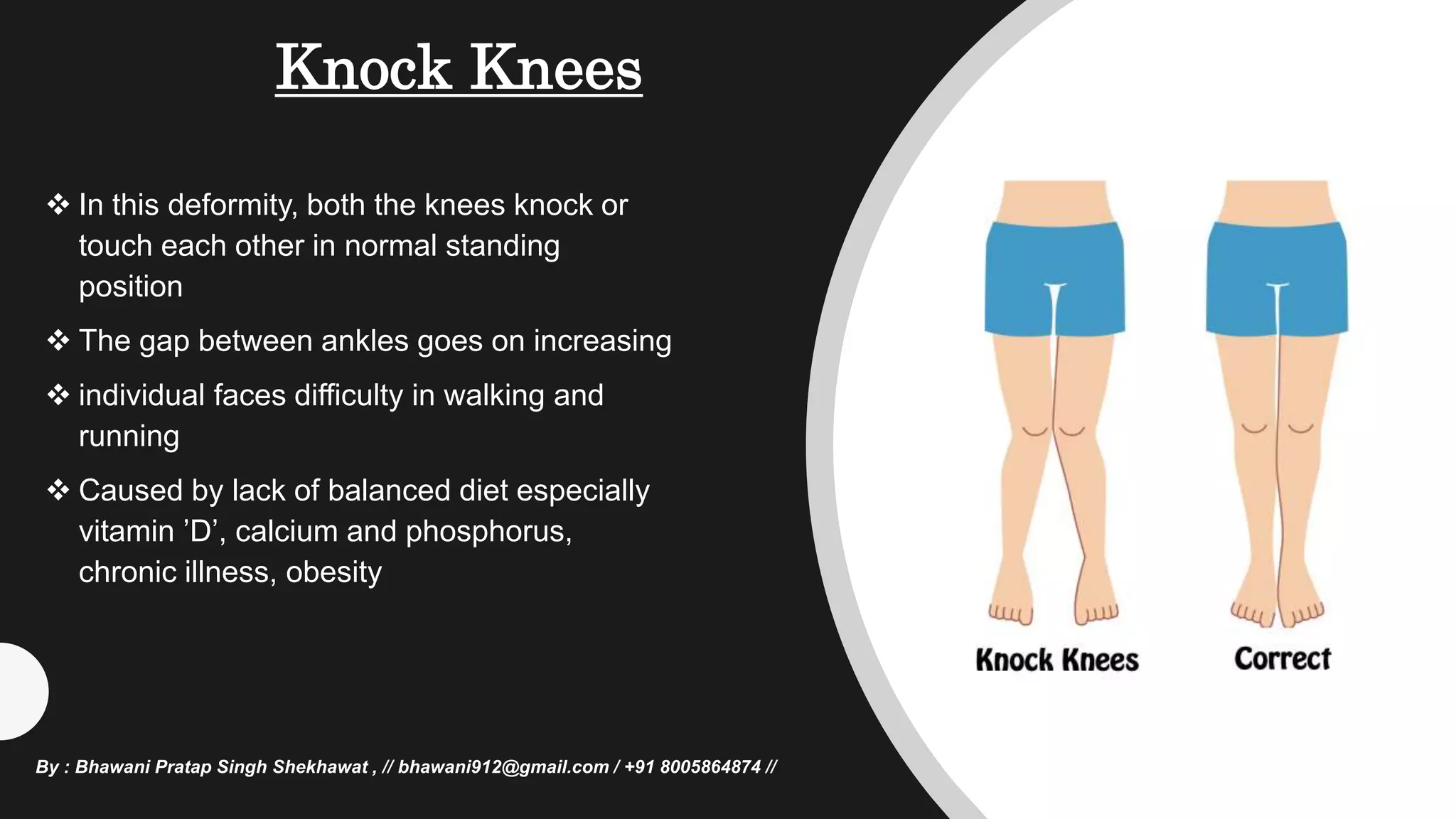 class 12th Ch 5 children and women in sports cbse by bhawani pratap ...