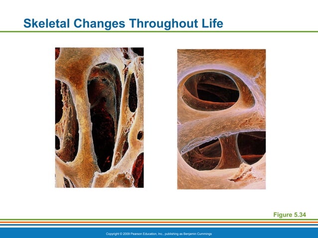 CVA A&P - Chapter 5d: Joints | PPT