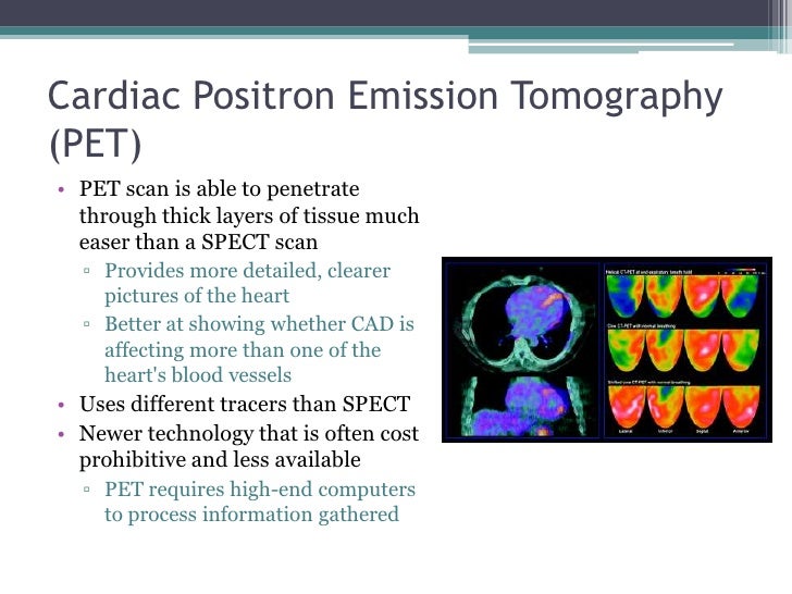 Cardiac Procedures