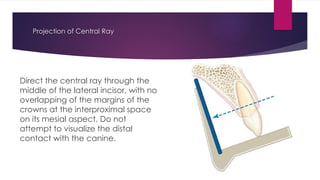 Oral Radiology White and Pharoah Ch 7 Intraoral.pptx