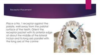 Oral Radiology White and Pharoah Ch 7 Intraoral.pptx