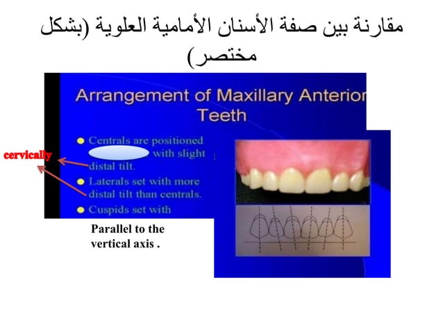 arrangement and setting teeth on the articulator | PPT