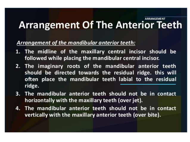 arrangement and setting teeth on the articulator | PPT
