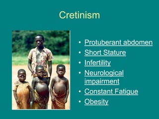 ch 9 endocrine diseases.ppt