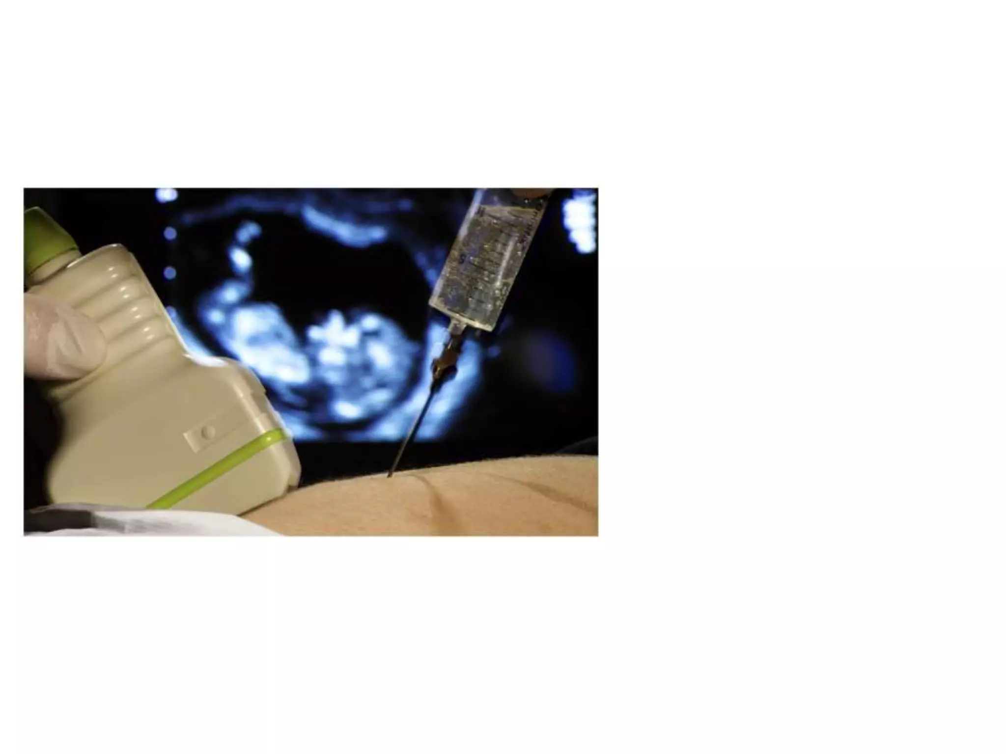 Ch 9 Sex And Meiosis Ppt Free Download