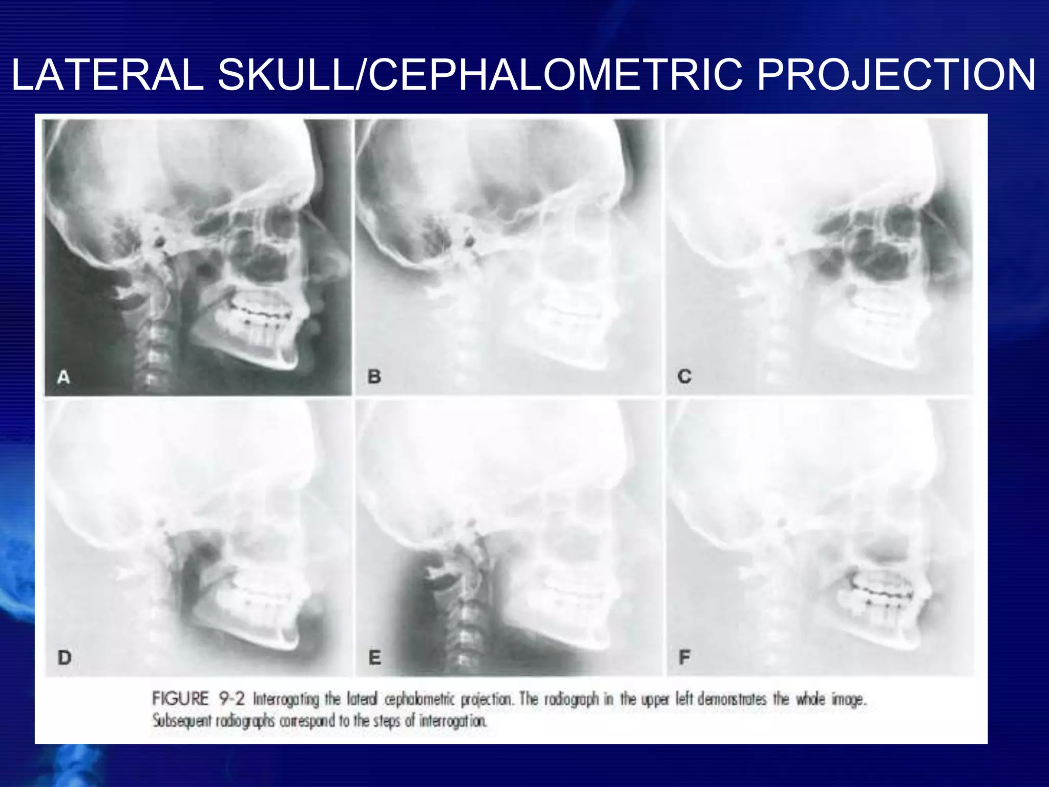 Extraoral radiography | PPTX