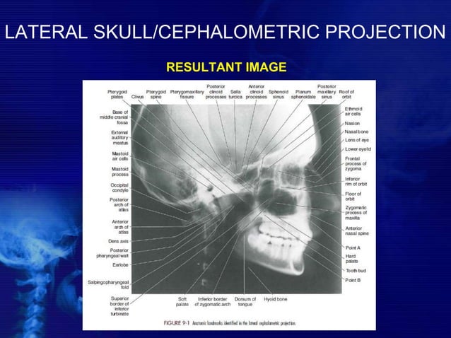 Extraoral radiography | PPTX