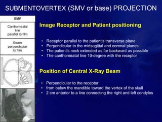 Extraoral radiography | PPTX
