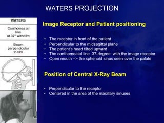 Extraoral radiography | PPTX