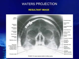 Extraoral radiography | PPTX