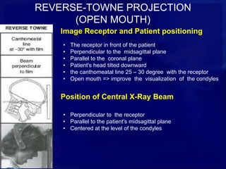 Extraoral radiography | PPTX