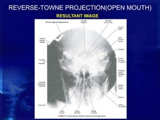 Extraoral radiography | PPTX